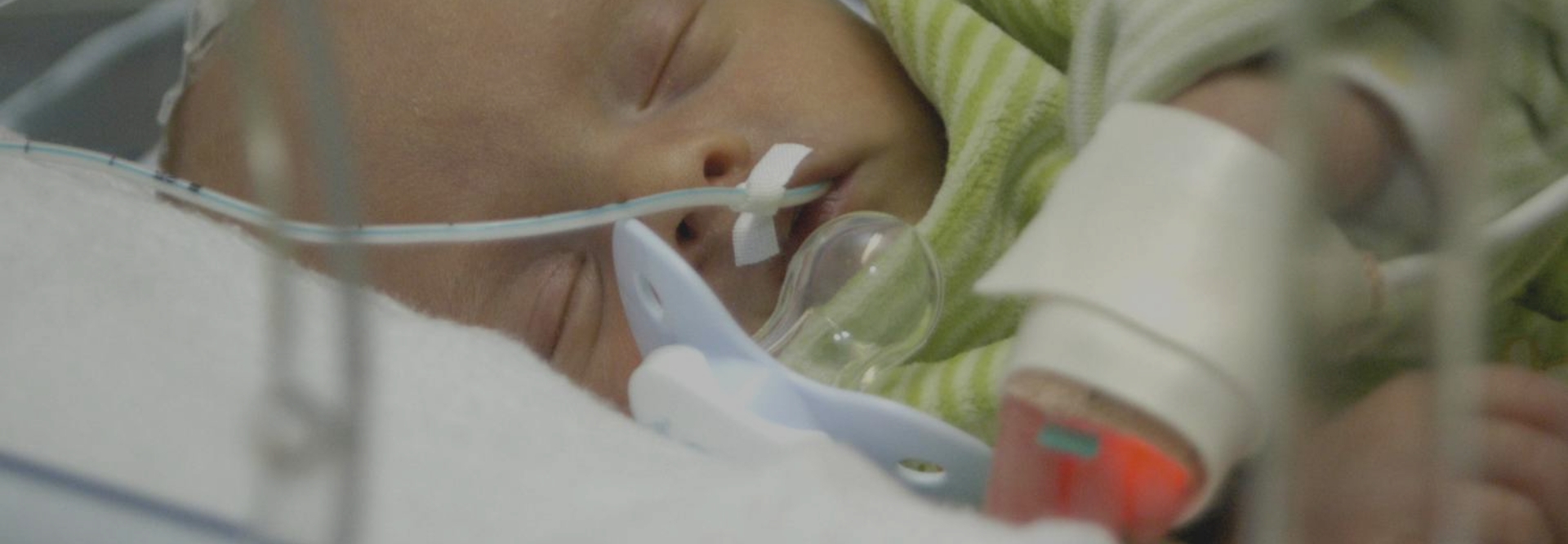 NG Tube Feeding Procedure Explained | RightBio Metrics