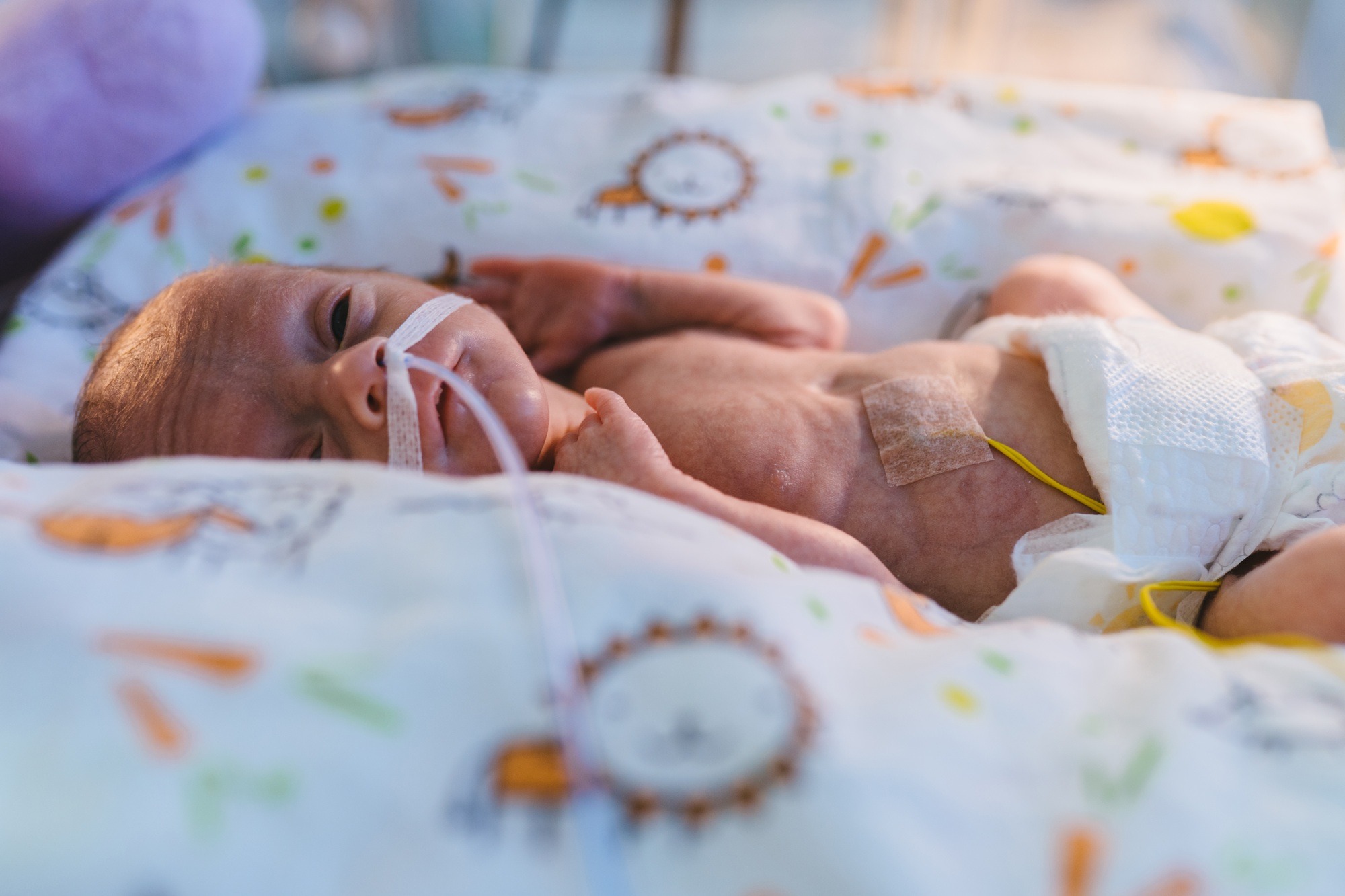 The Hidden Risk of Neonatal Growth In Tube Placement - Case Study
